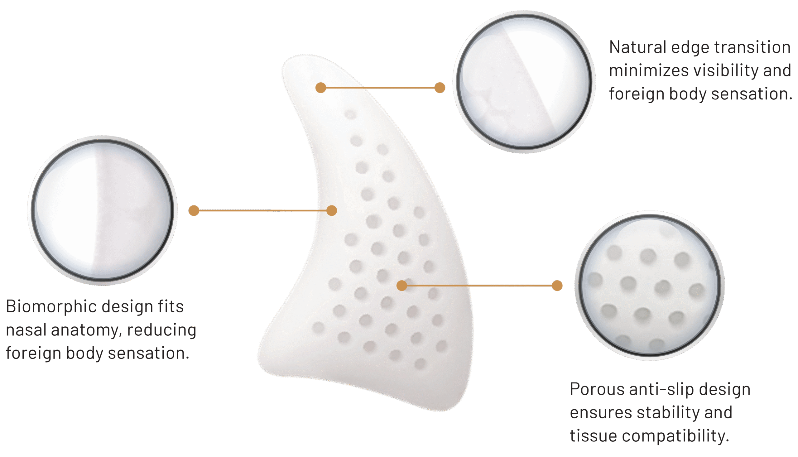 Facial Implants Paranasal